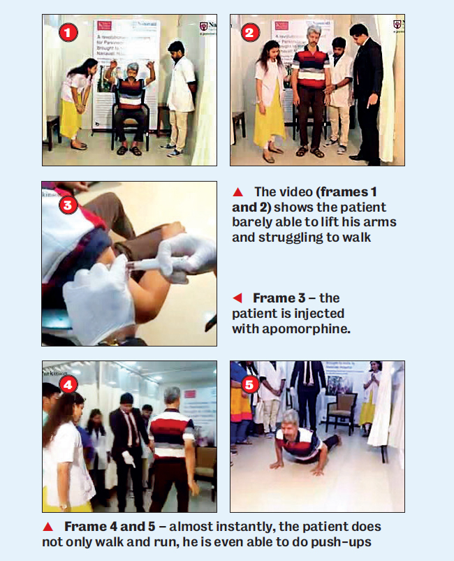 Apomorphine: Docs object to Nanavati pushing drug as panacea for ...