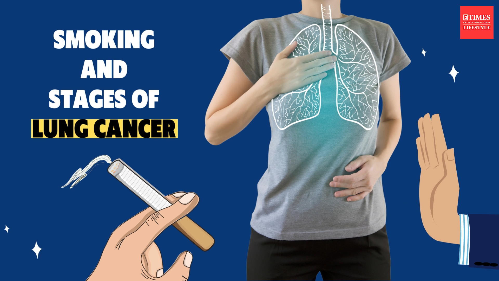 Smoking and stages of lung cancer