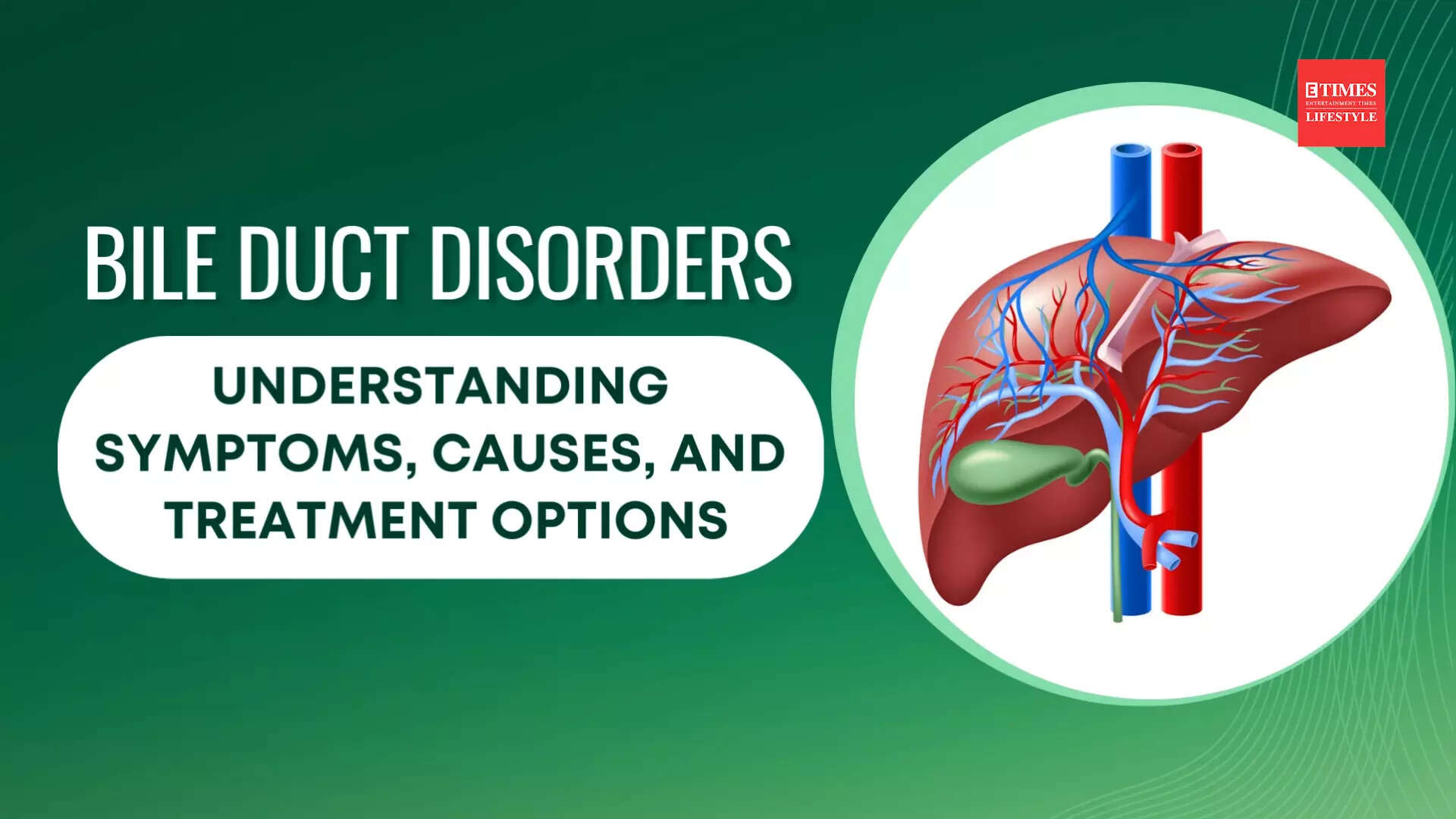 Bile duct disorders: Understanding symptoms, causes, and treatment options
