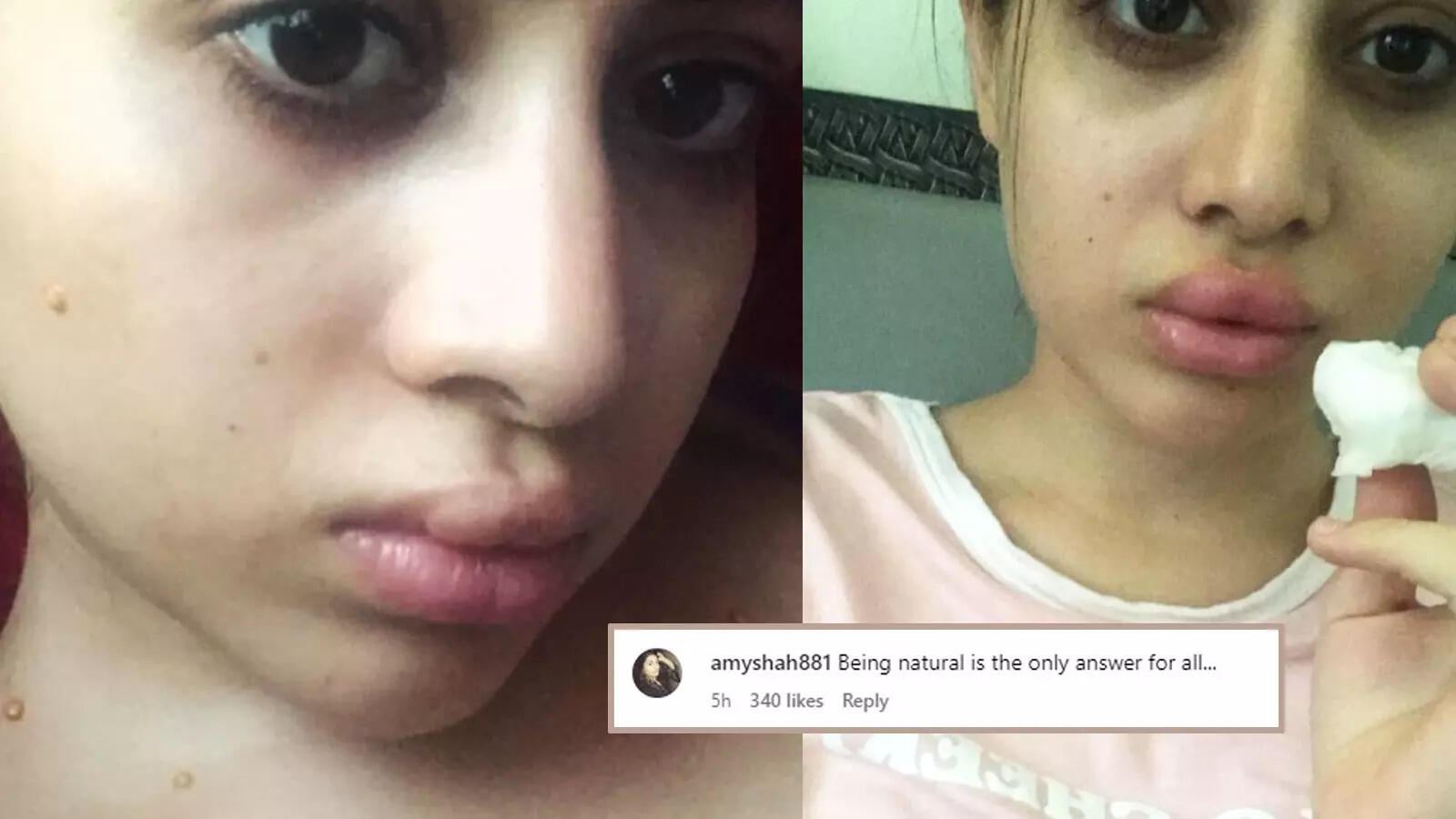 Urfi Javed reveals getting lip fillers from the age of 18: 'Instead of ...