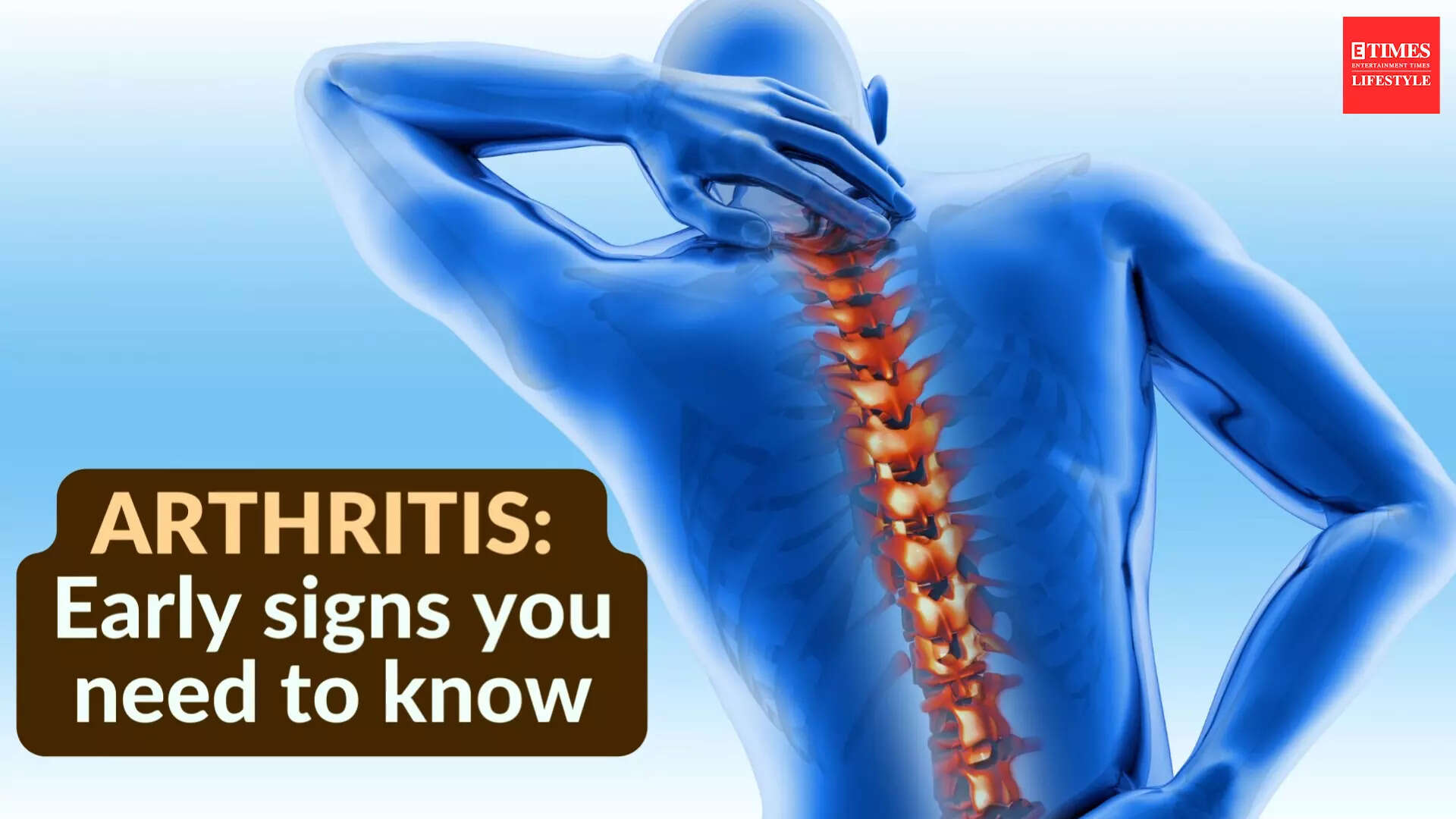 Arthritis: Early signs to know