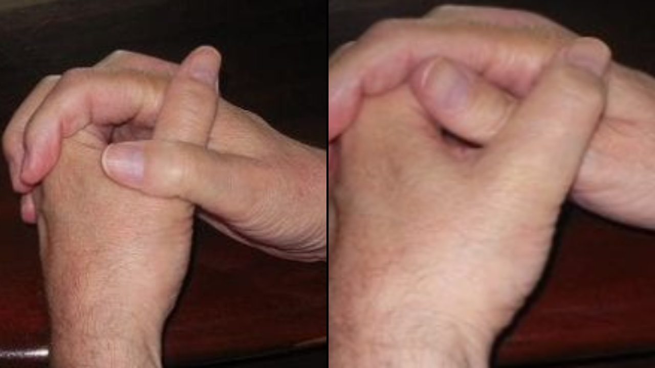 Personality test: How you cross your thumbs together…