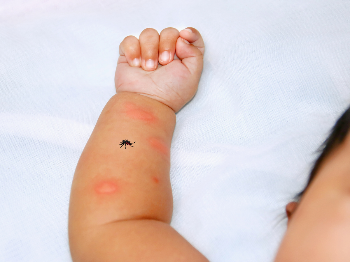 Dengue Outbreak: Are kids at a higher risk of developing severe dengue ...