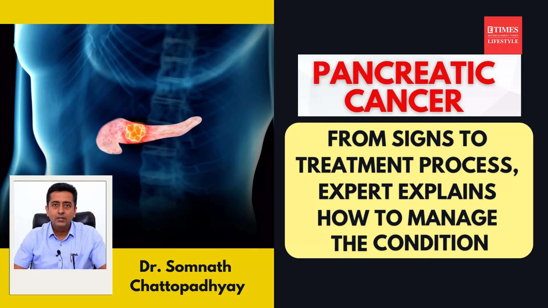 cancer, signs, treatment, manage, condition: Pancreatic cancer From ...
