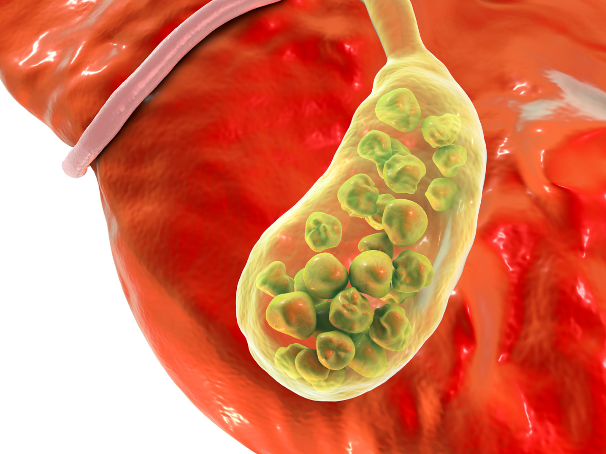 Bile Duct Cancer: Early warning signs of Bile Duct Cancer you must ...