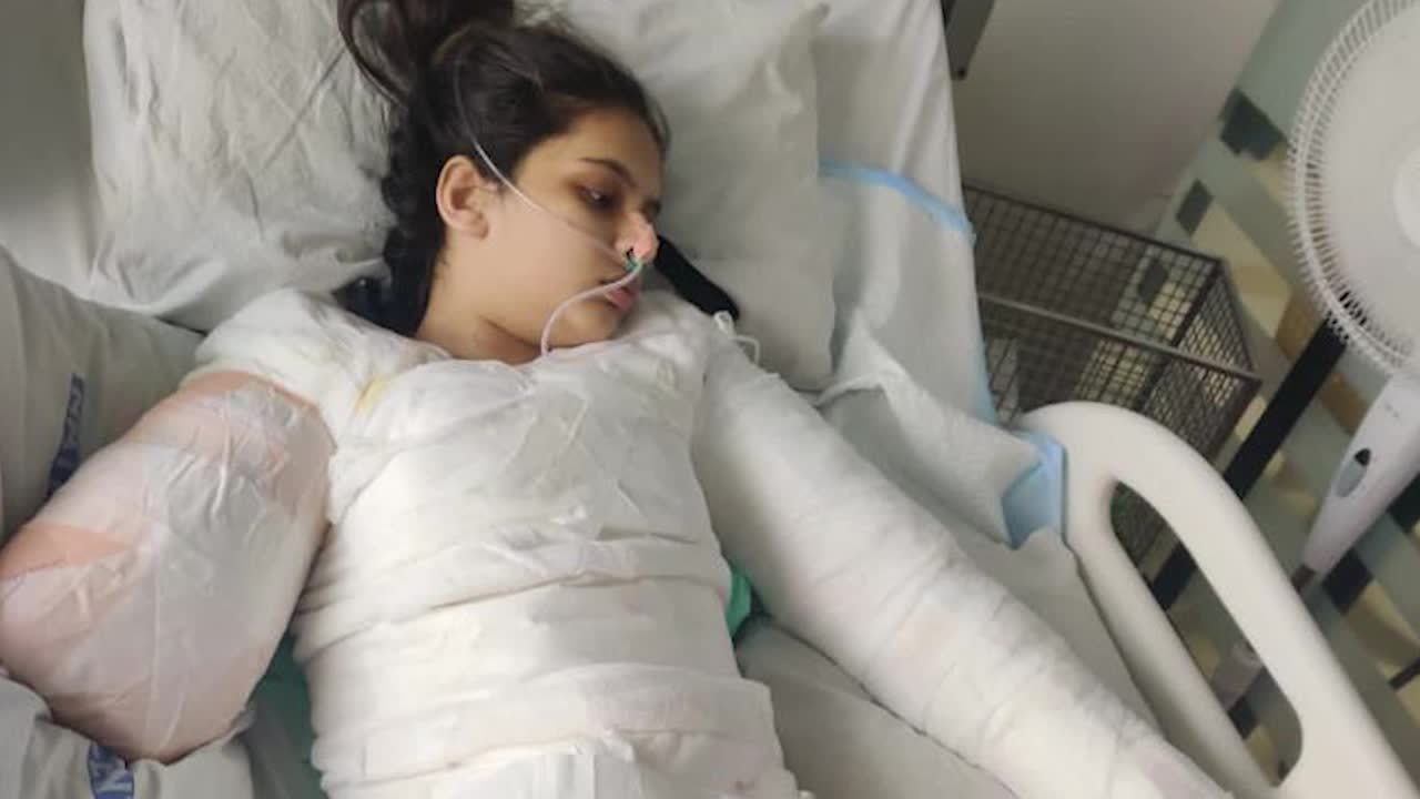 Mumbai girl who lost right arm after jolt from High Tension cable ...