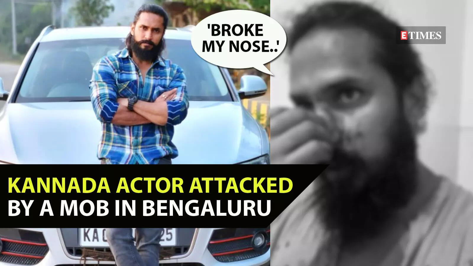 Shocking encounter: Kannada actor Chetan Chandra assaulted by a mob in Bengaluru; shares ...