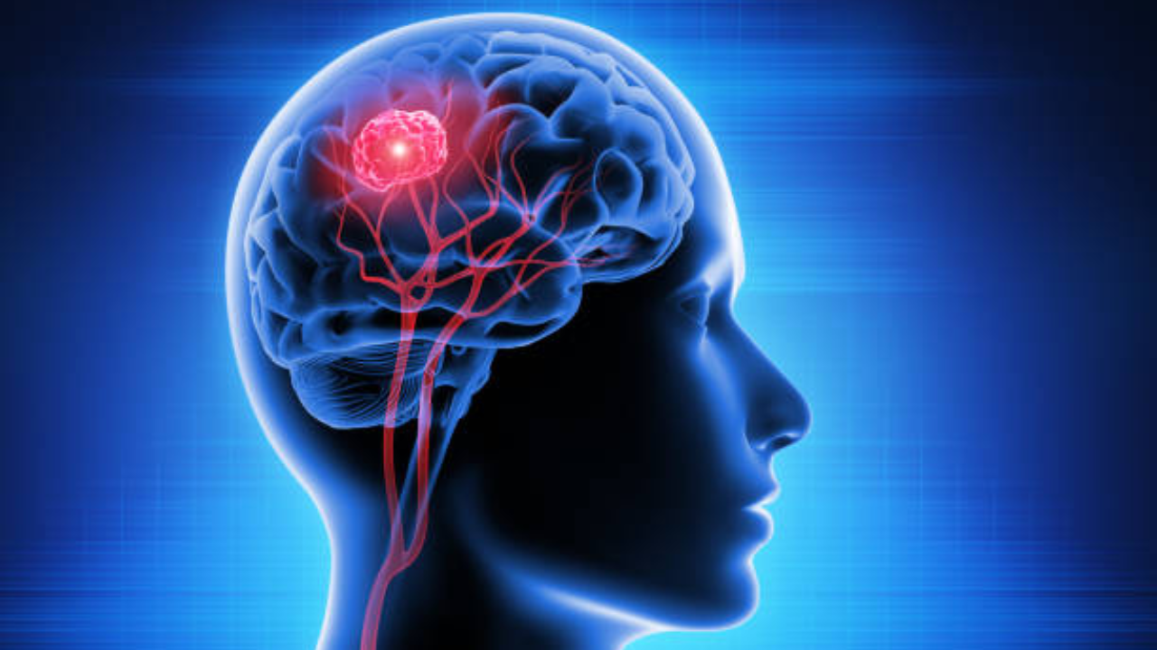 What are the signs and symptoms of brain tumors that…