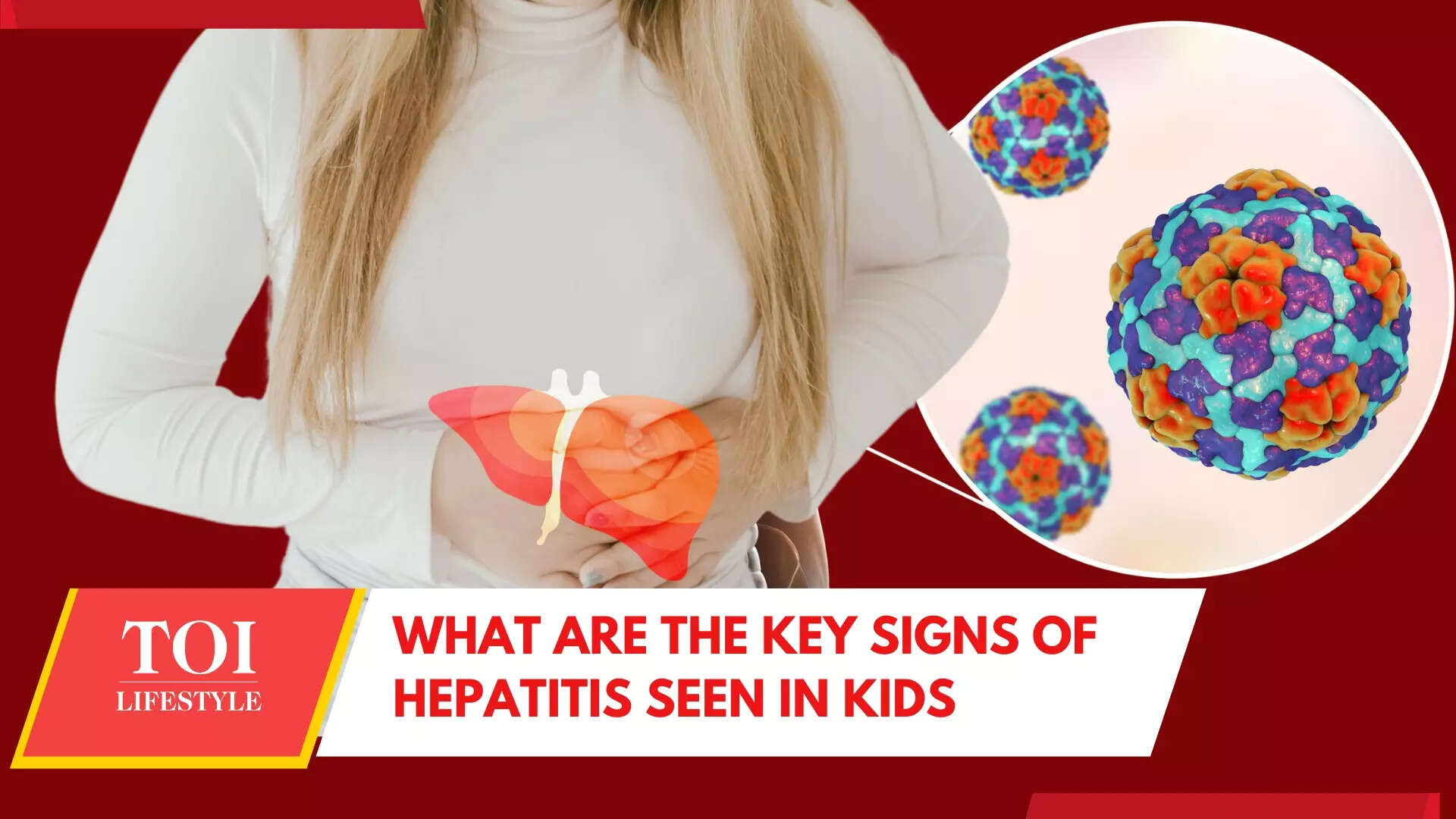 What are the key signs of hepatitis seen in kids