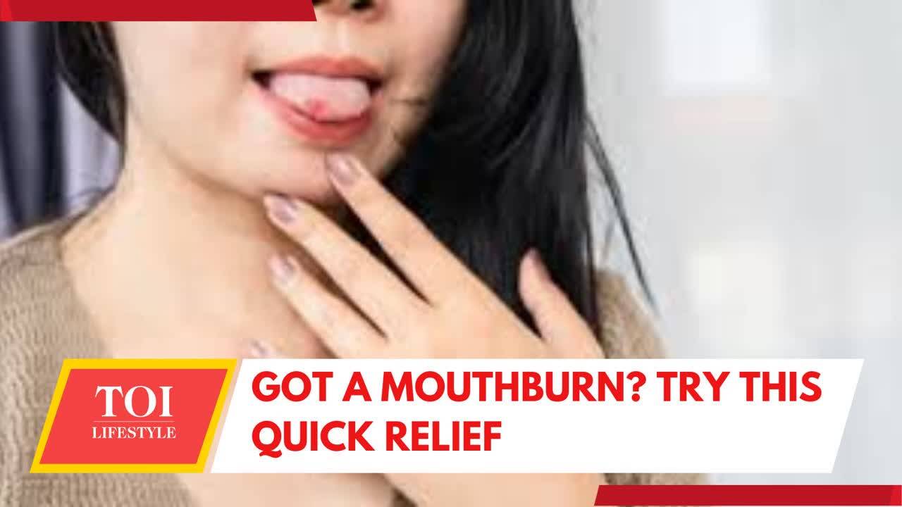 Effective Home Remedies to Soothe and Heal Burnt Mouth