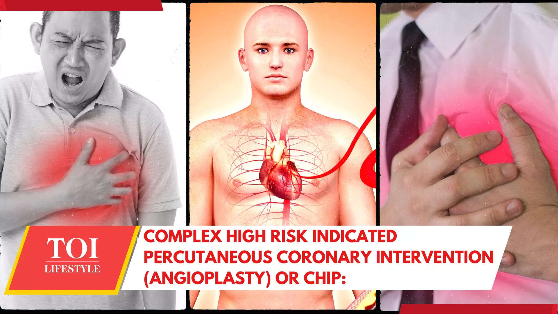 All about Complex High Risk Indicated Percutaneous Coronary Intervention (Angioplasty) or CHIP