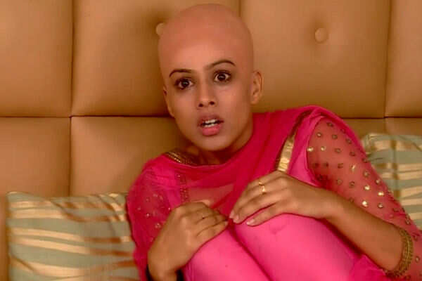 TV actors who sported the bald look