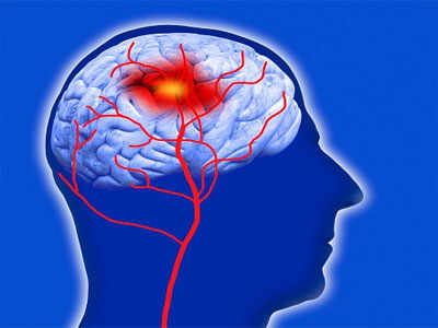 A mutiny against the brain