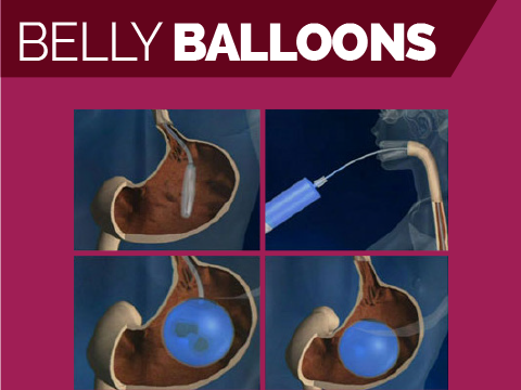 Infographic: Infographic: BELLY BALLOONS - Times of India