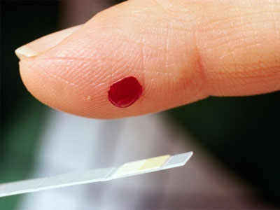 Single drop blood tests many not be accurate