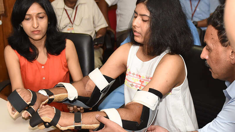 Asia's first upper arm double hand transplant performed at Kochi hospital