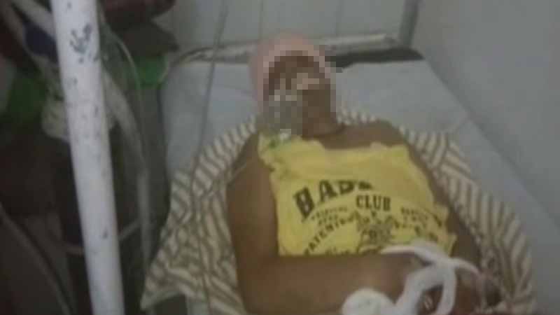 Shocking medical negligence: MP Man declared brain dead found alive ...