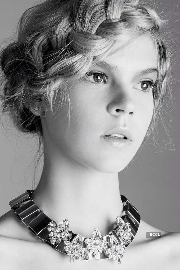 Beauty queen with a rare genetic disorder wins pageant