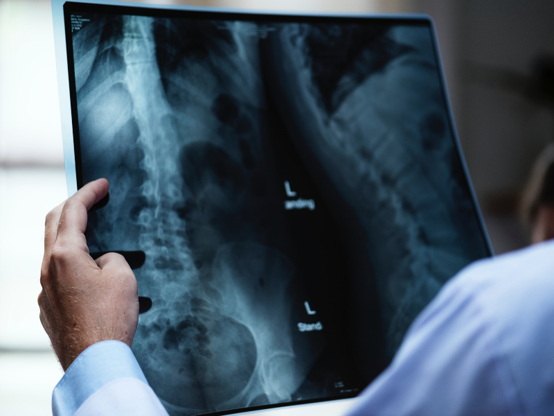 9 of the weirdest things doctors have removed from a patient's body