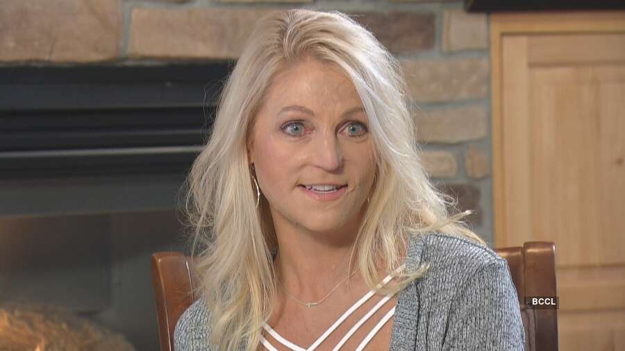 Beauty queens who suffered horrific burn injuries