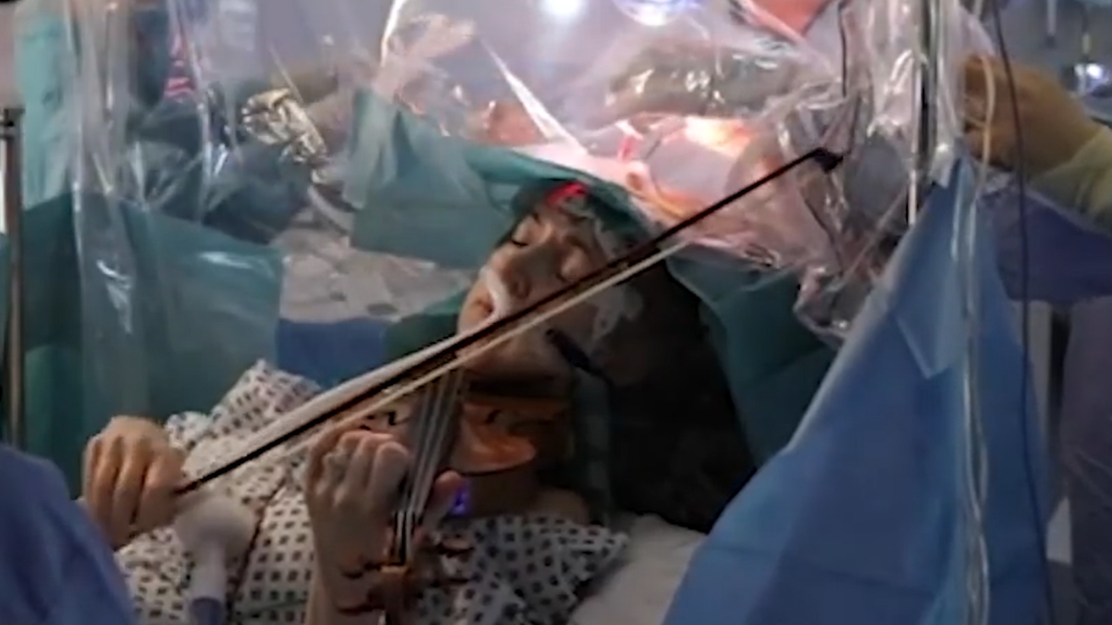 Watch: Female violinist plays instrument during brain surgery