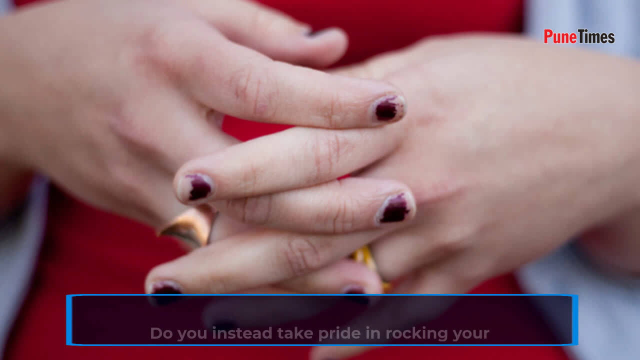 Gross chipped nails has now become a hot trend!