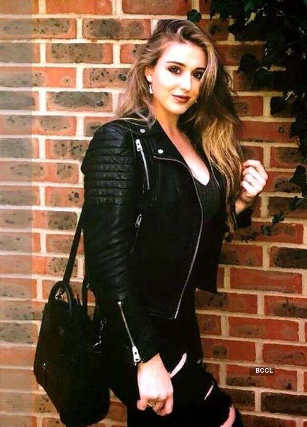 Beauty Queen left with horrific facial injuries in bar fight