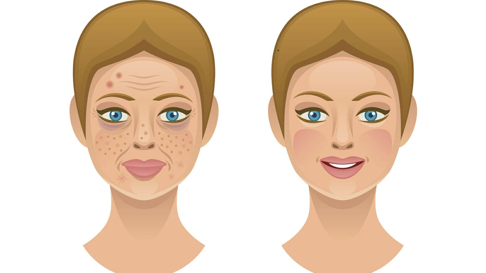Here's how the lockdown is affecting your skin