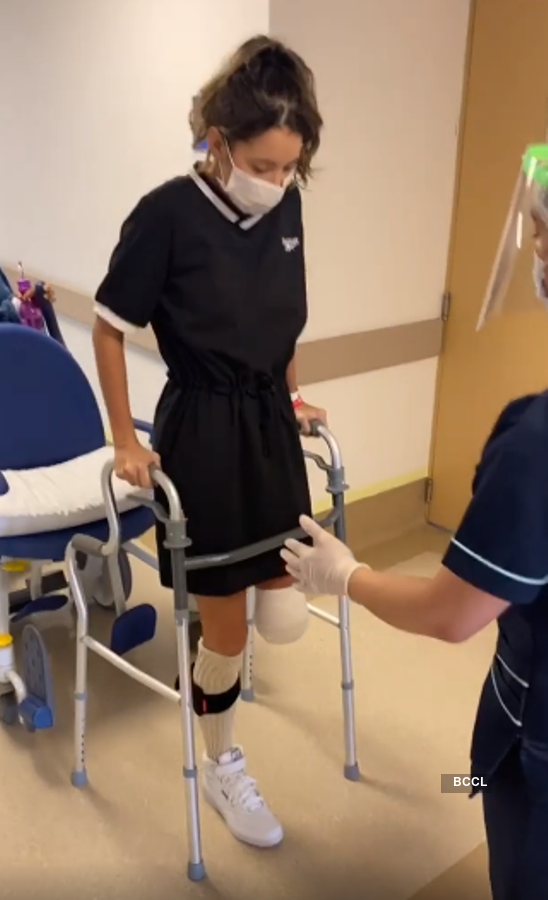 Former beauty queen walks again after left leg being amputated
