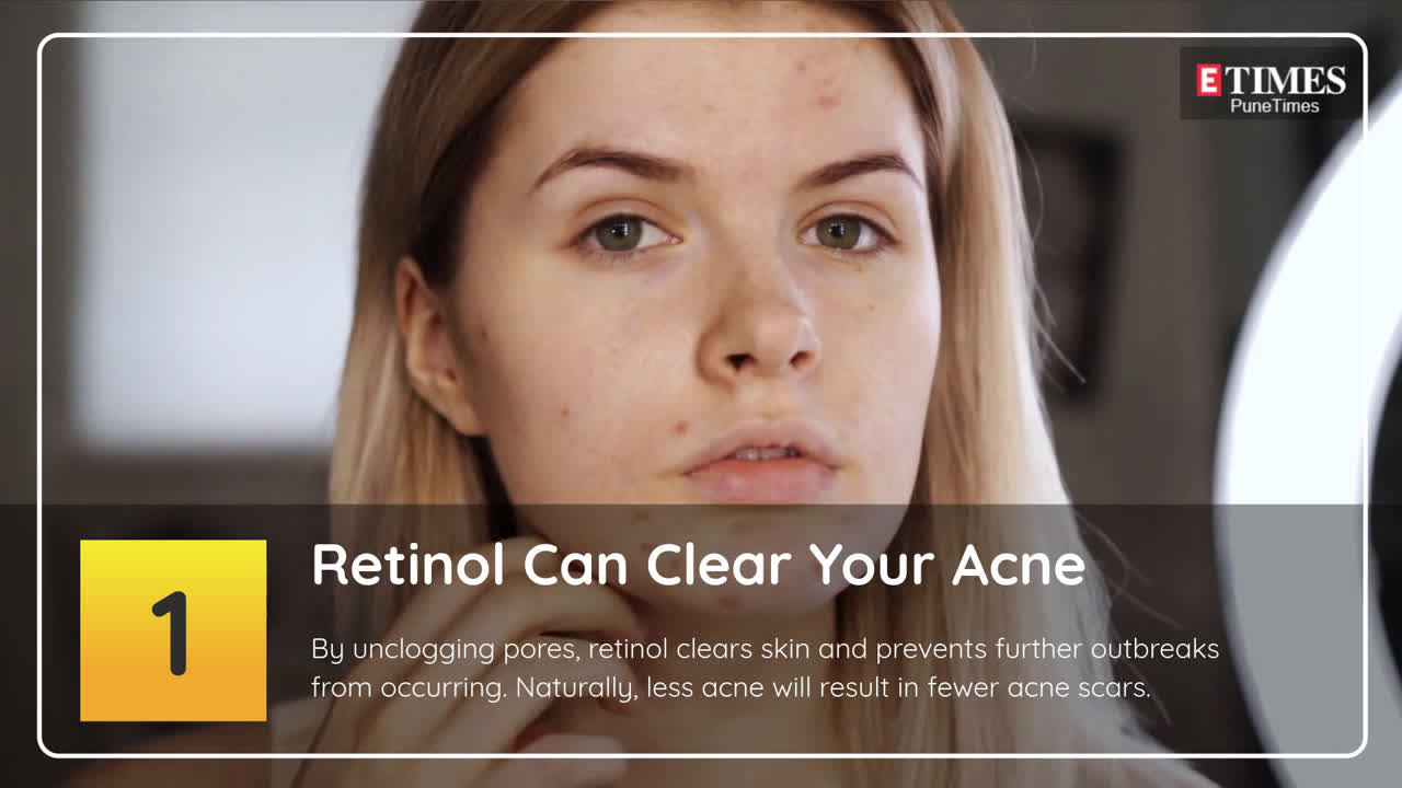 Pimple: Retinol is what you need, in order to change your skin care game