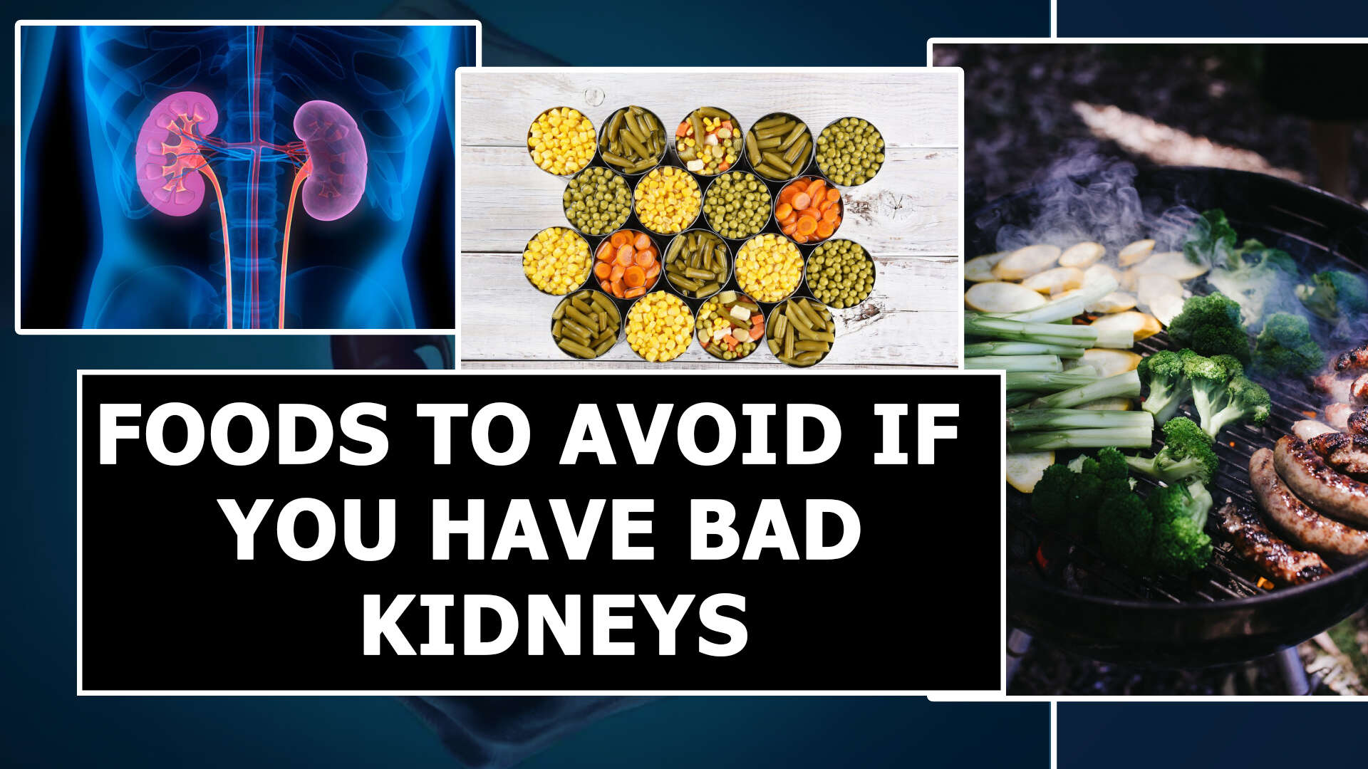 Foods to avoid if you have bad kidneys