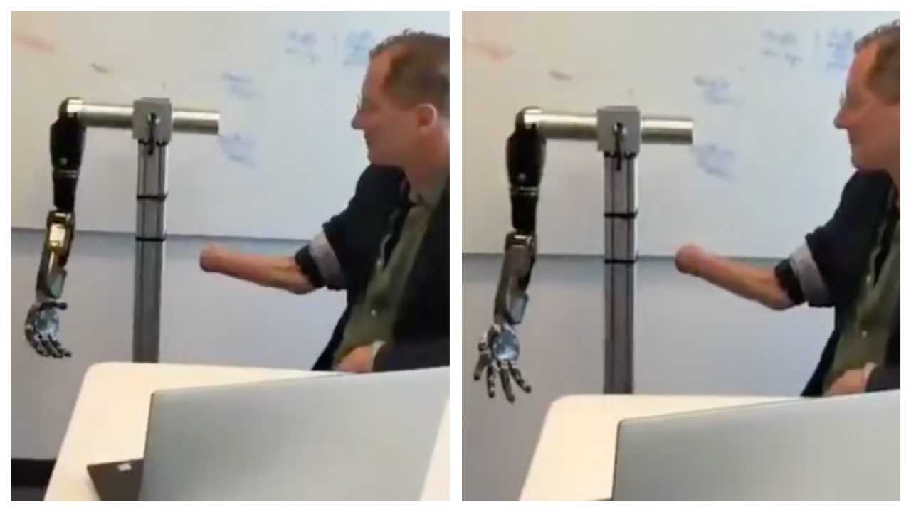 Watch: Bionic arms have come a long way!