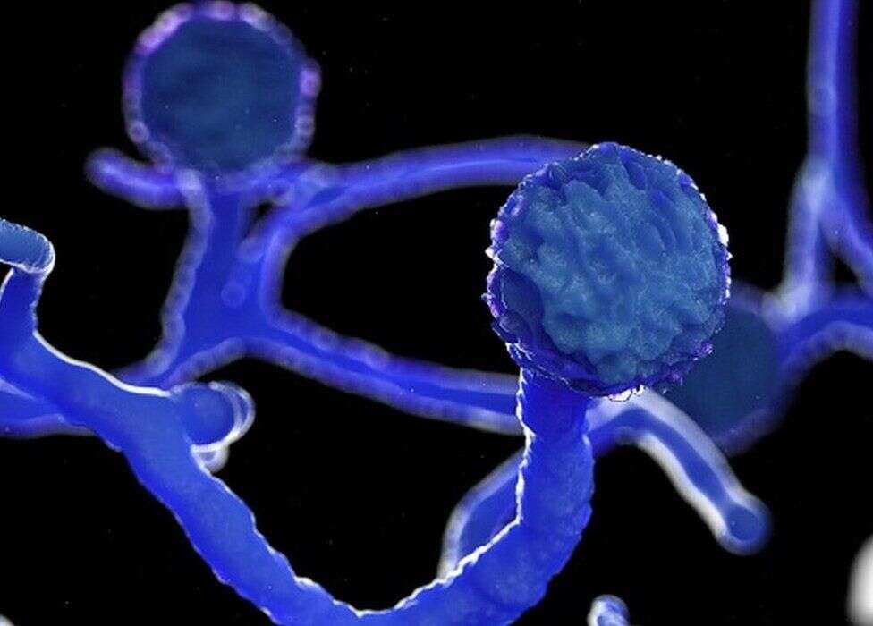 Mucormycosis Black fungus: All you need to know about the black fungal ...