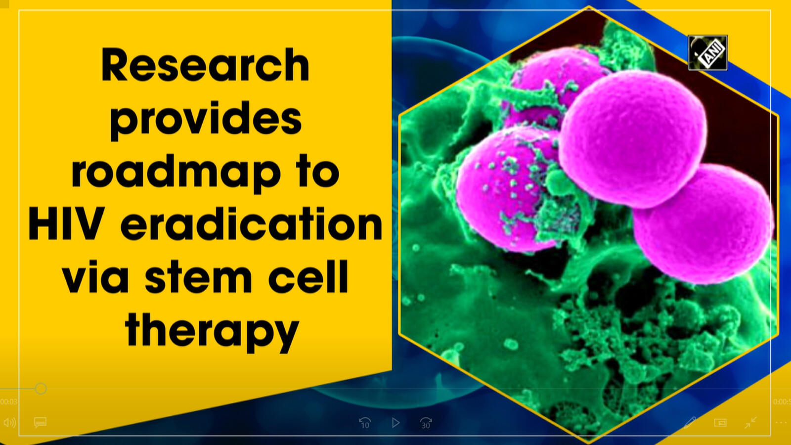 Research provides roadmap to HIV eradication via stem cell therapy