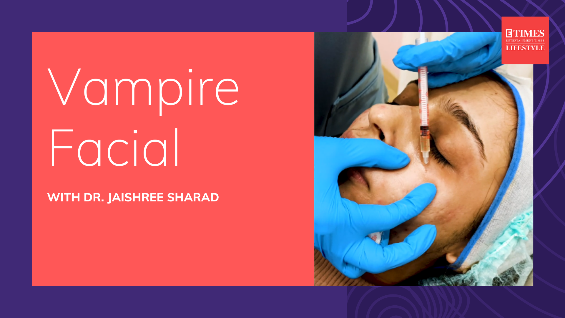 We tried the Vampire Facial