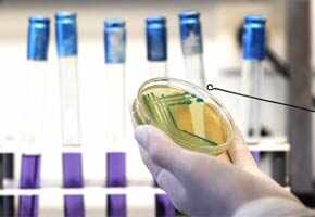 Germany says bean sprouts likely E coli infection source