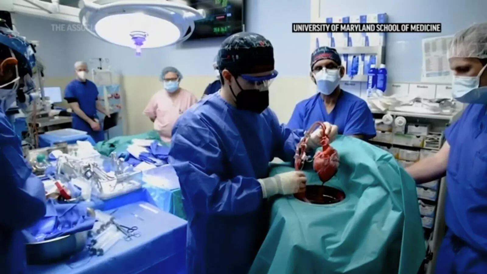 Doctors transplant pig heart into a patient