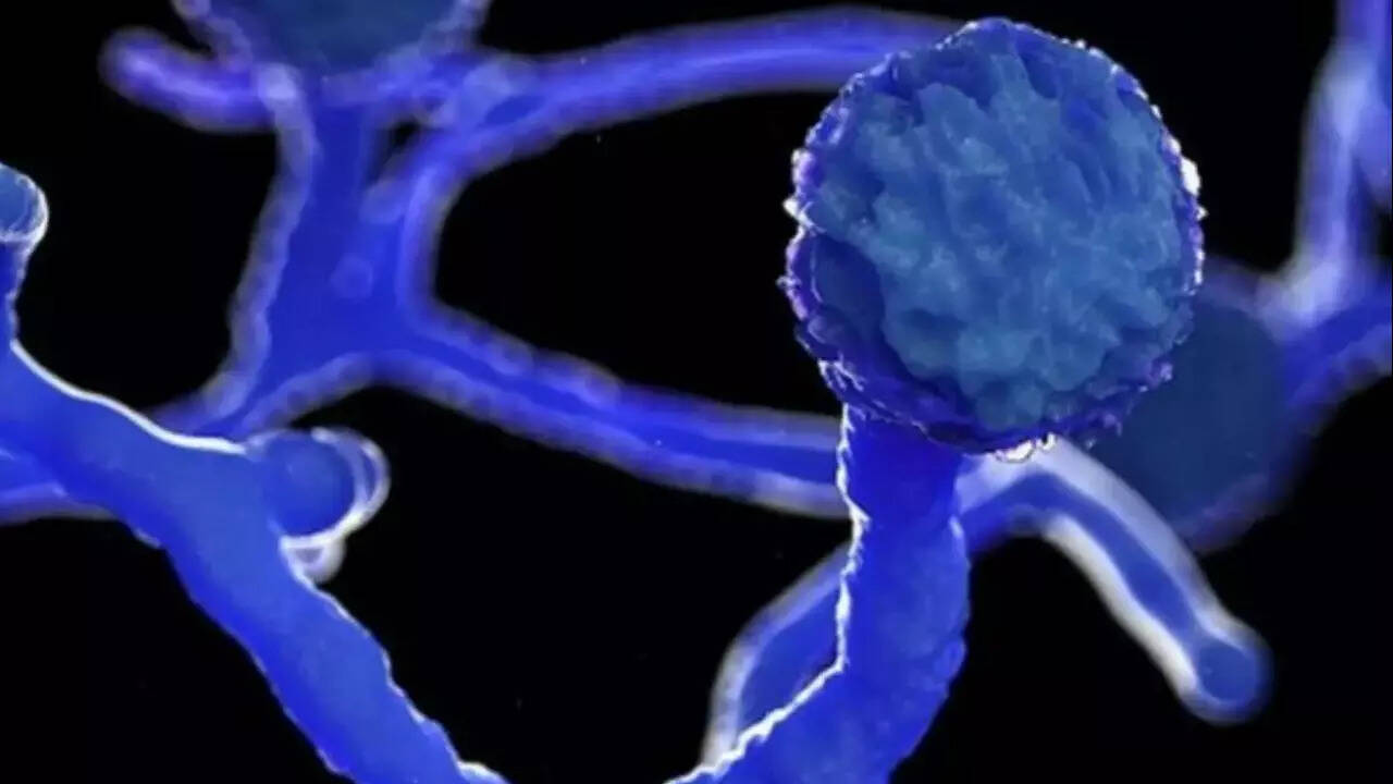 Mumbai: Mucormycosis case surfaces again, now due to…