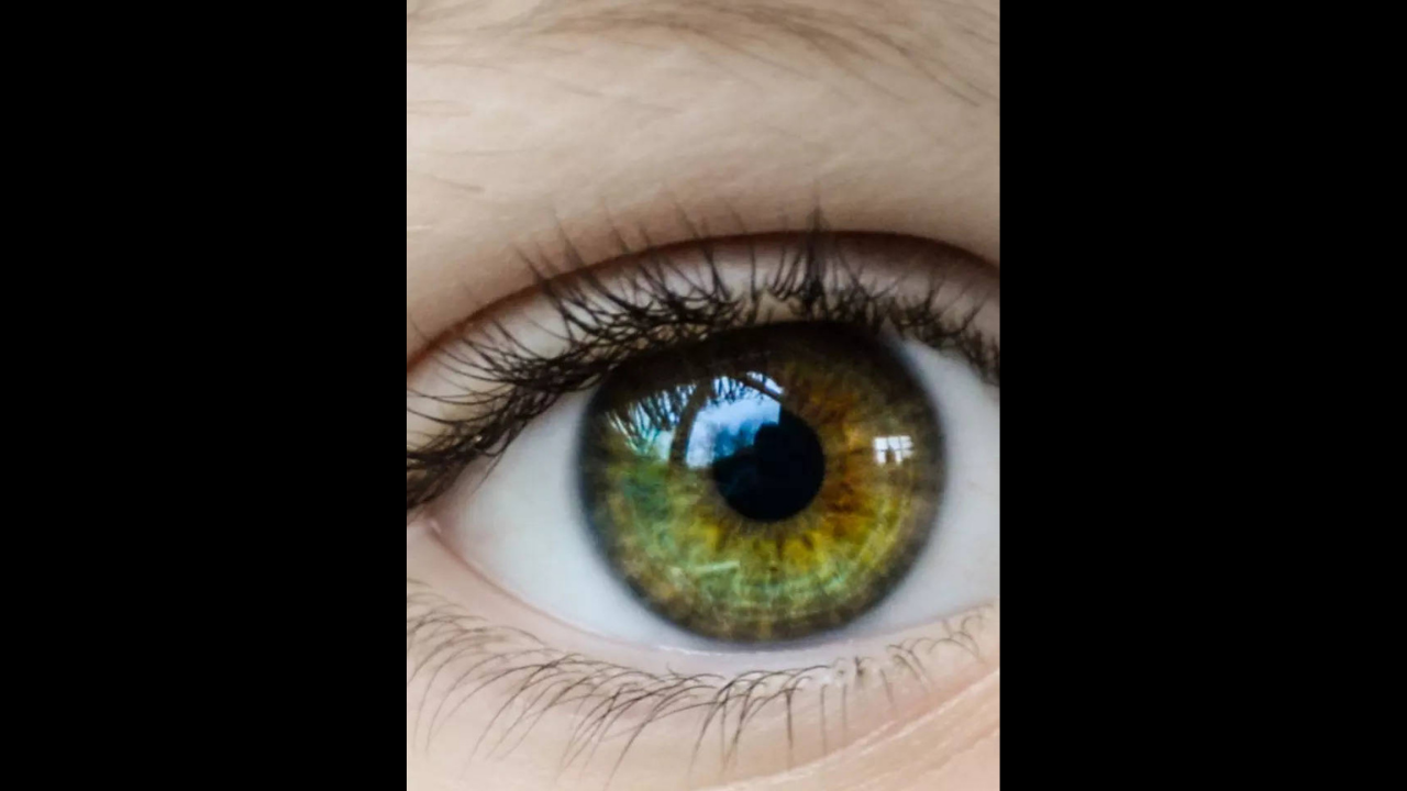 Pune: ‘Measure retinal spider veins to track vision…