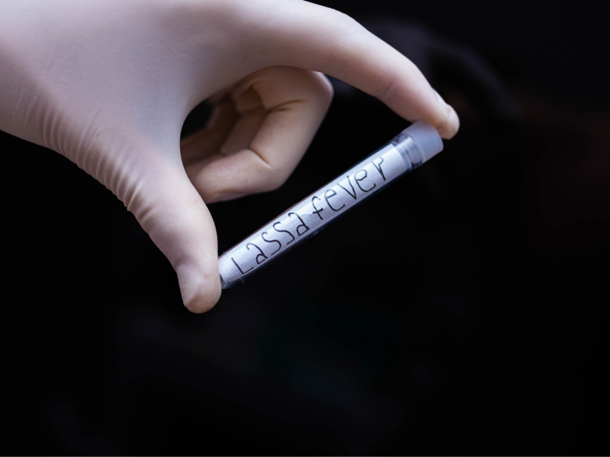 As rat-caused Lassa fever enters UK after a decade; know everything ...