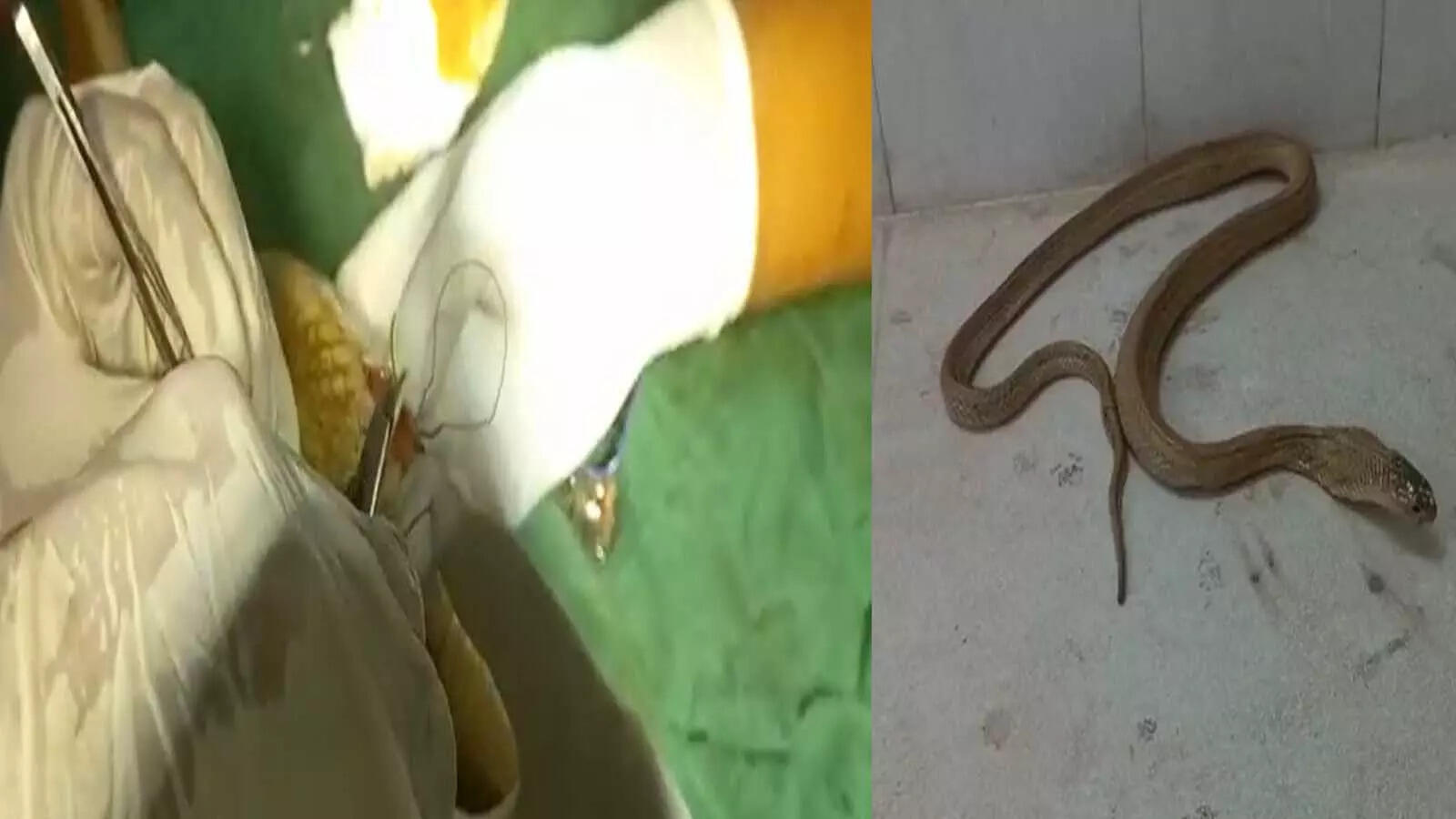 Watch: Doctors conduct surgery on cobra to remove plastic cap from abdomen