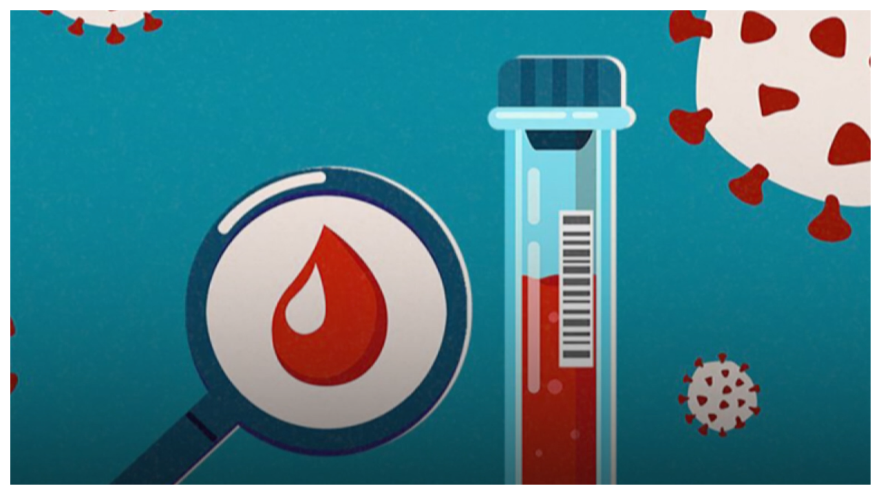 Study reveals, COVID-19 increases risk of Type 2 Diabetes