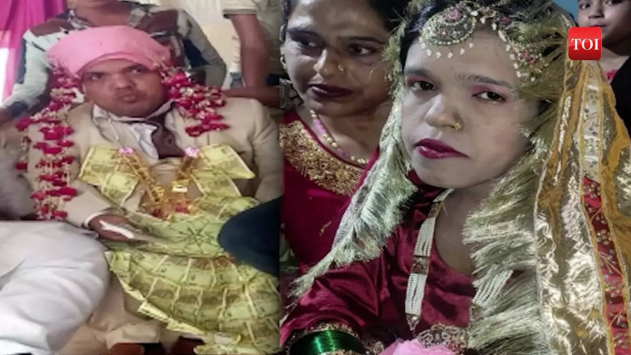 Rampur: Wedding of a dwarf couple went viral