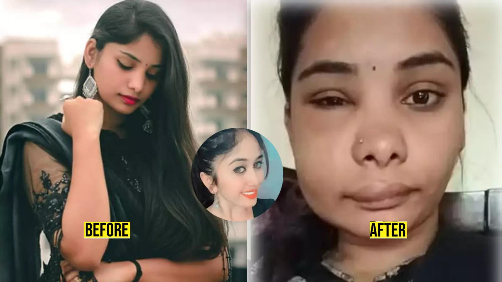 After Chethana Raj’s fatal plastic surgery, now Swathi Sathish’s root ...
