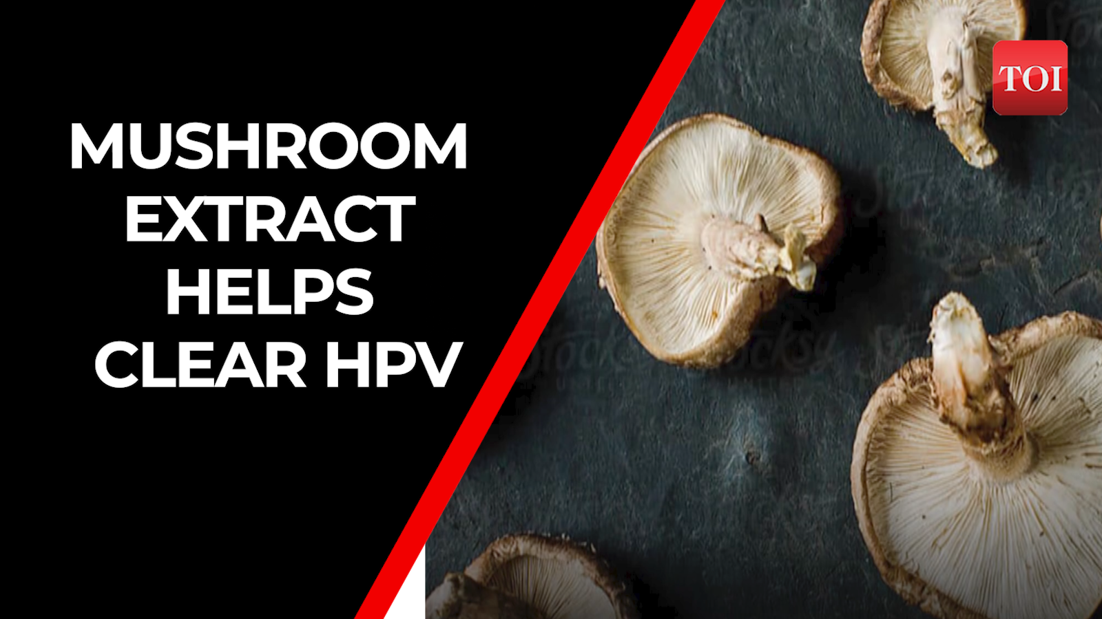 Study: Mushroom extract supports clearing human papillomavirus (HPV ...