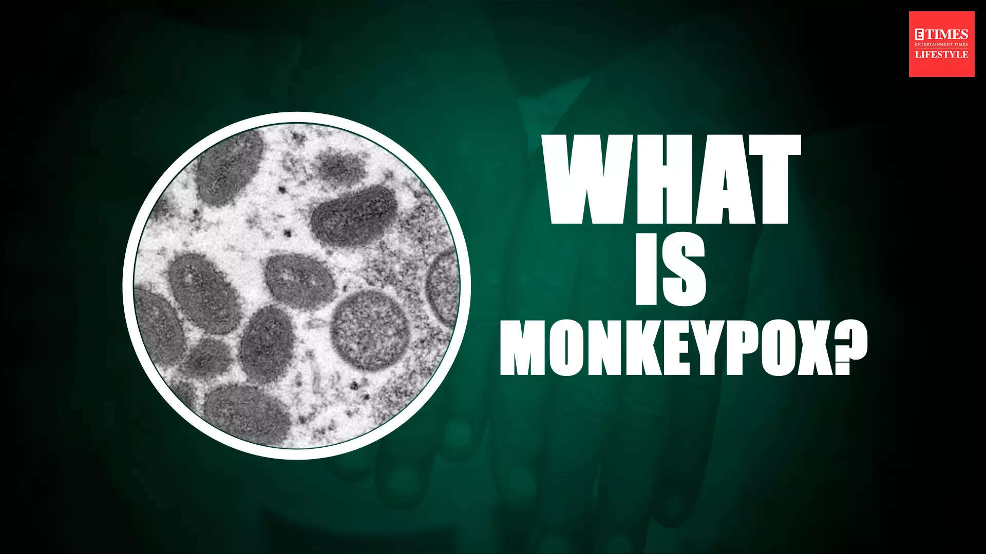 monkeypox: What is monkeypox?