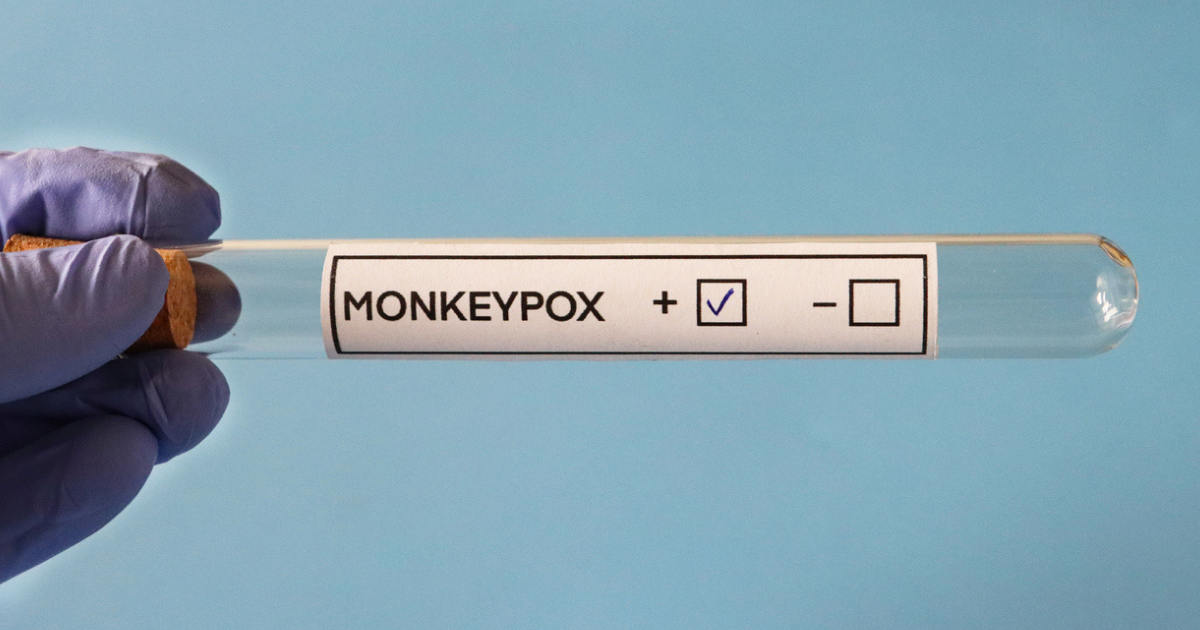 Explainer: Here’s how 2022 monkeypox outbreak is different from ...