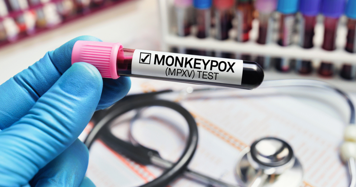 Monkeypox: From a new name to vaccine production, latest developments