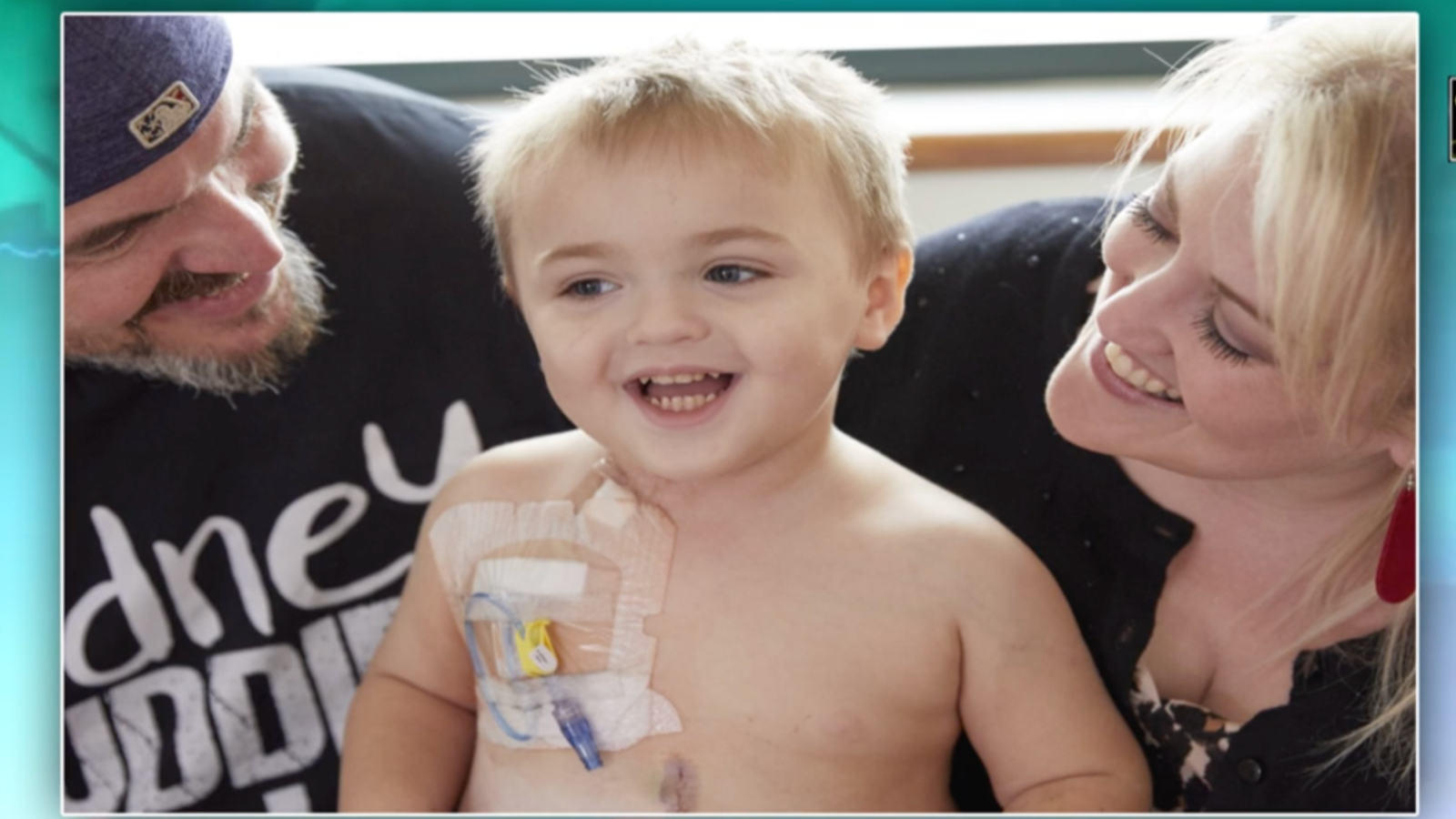 Study finds paediatric kidney transplant patients fare better when ... Study finds paediatric kidney transplant patients fare better when ...