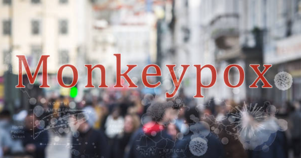 Monkeypox: Human to animal transmission reported, key points to know to ...